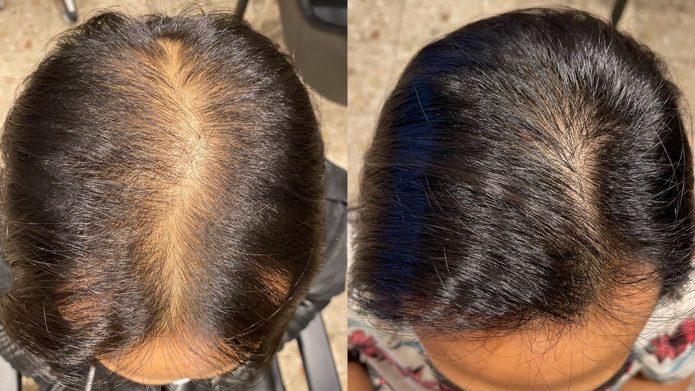 生发案例 – Unit3 Studio